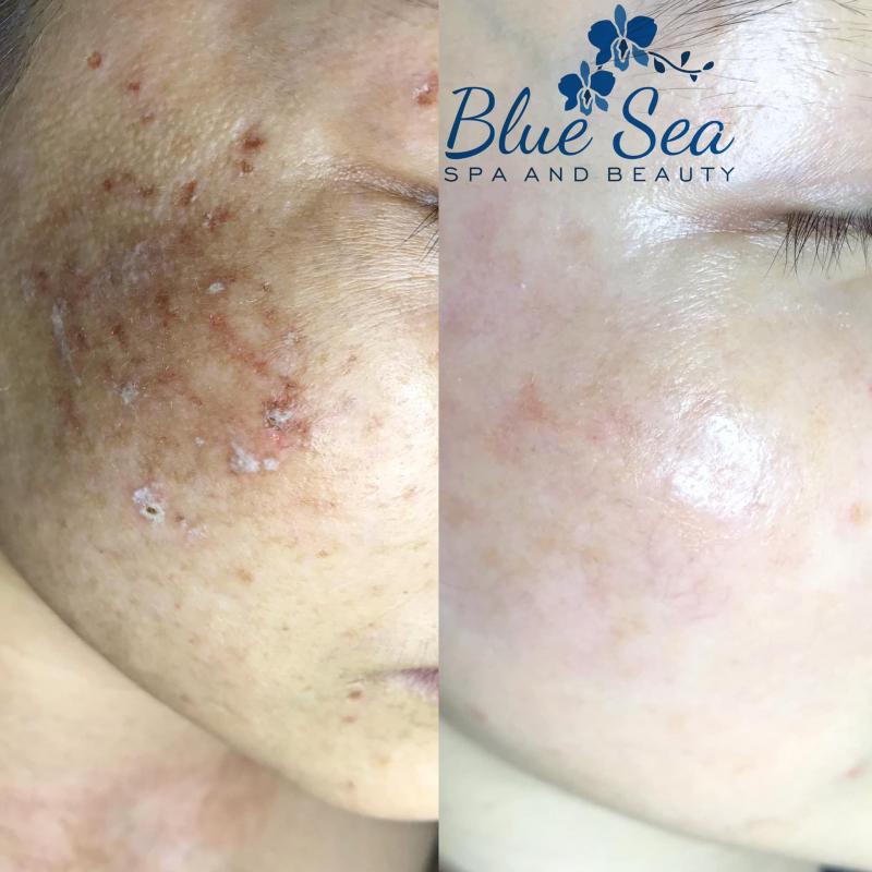 Top 6 Spa trị nám tốt nhất TP. Rạch Giá, Kiên Giang - Toplist.vn