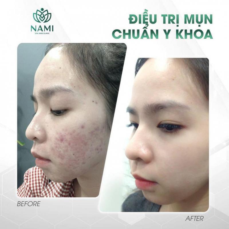 Top 10 Spa chăm sóc da tốt nhất Hải Phòng - Toplist.vn