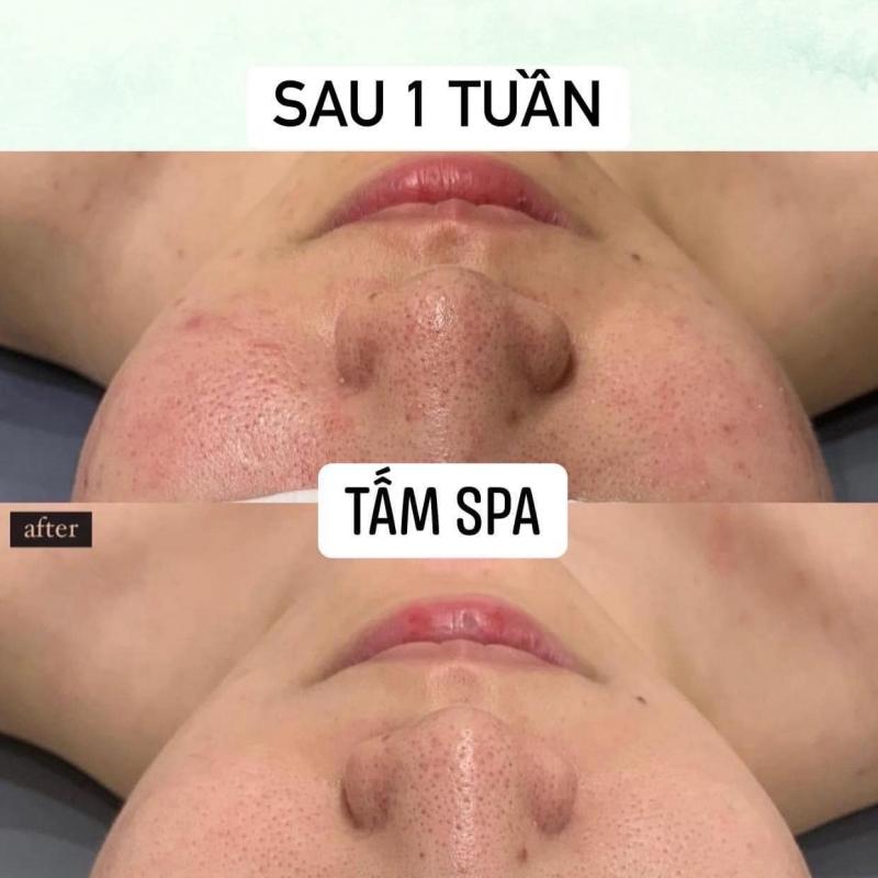 Top 8 Spa làm đẹp uy tín và chất lượng nhất Bạc Liêu - toplist.vn